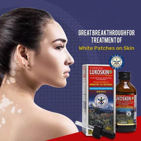 Buy Lukoskin Medicine For Vitiligo, Aimil Lukoskin Online Order India ...